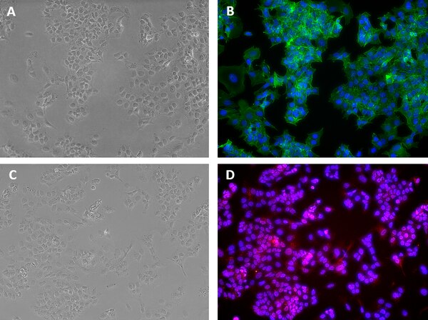 HCI-EC-23 Human Endometrial Cancer Cell Line | SCC641